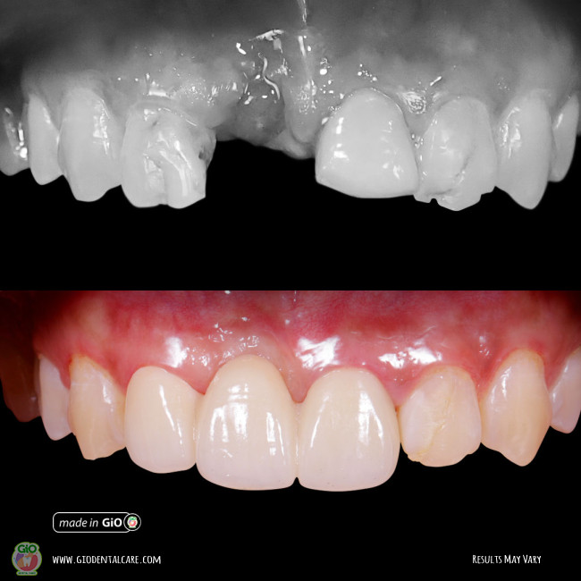 GiO Dental Care